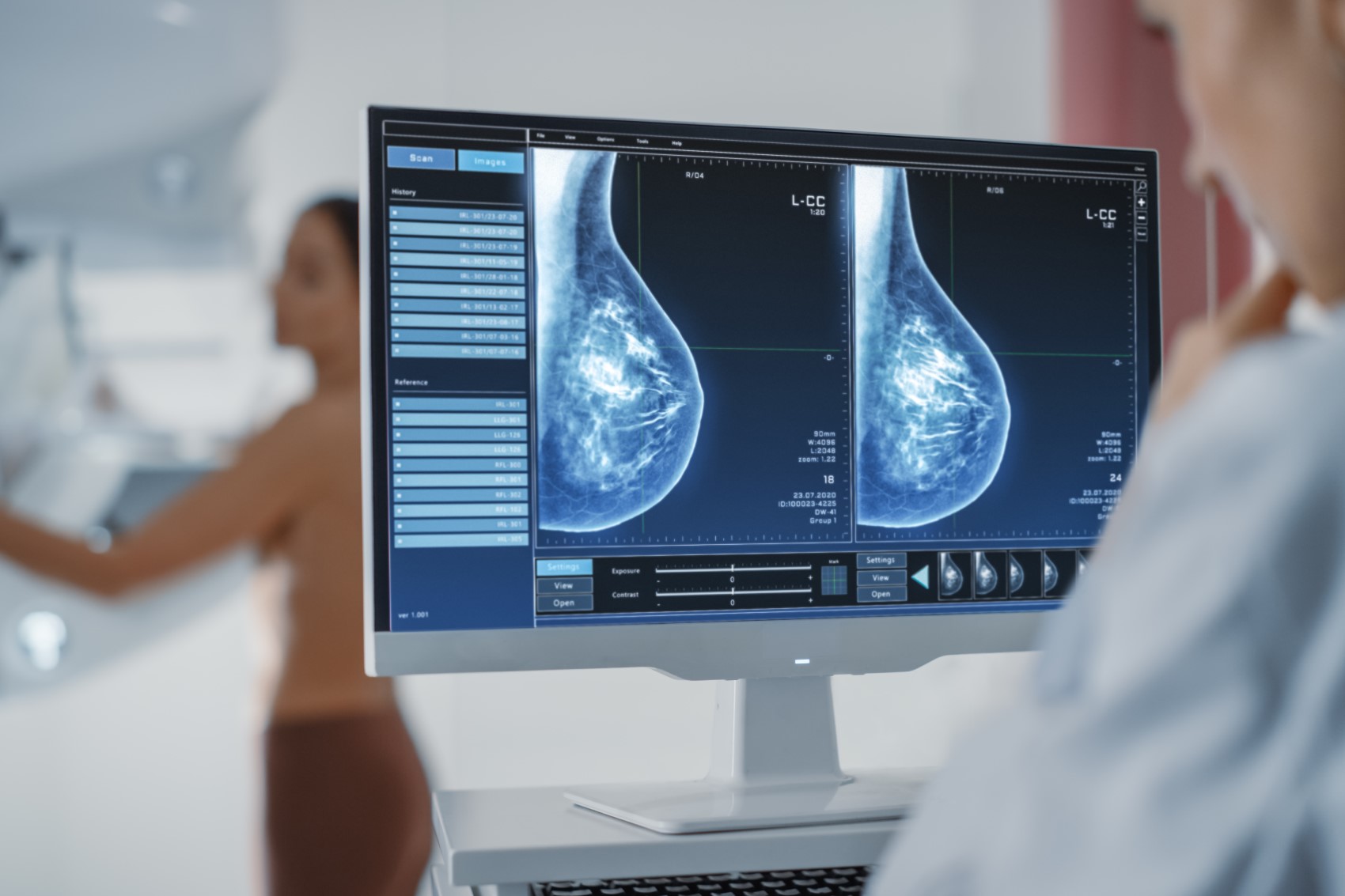 A Guide to Your Mammogram Results Phoenix AZ | Genesis OBGYN